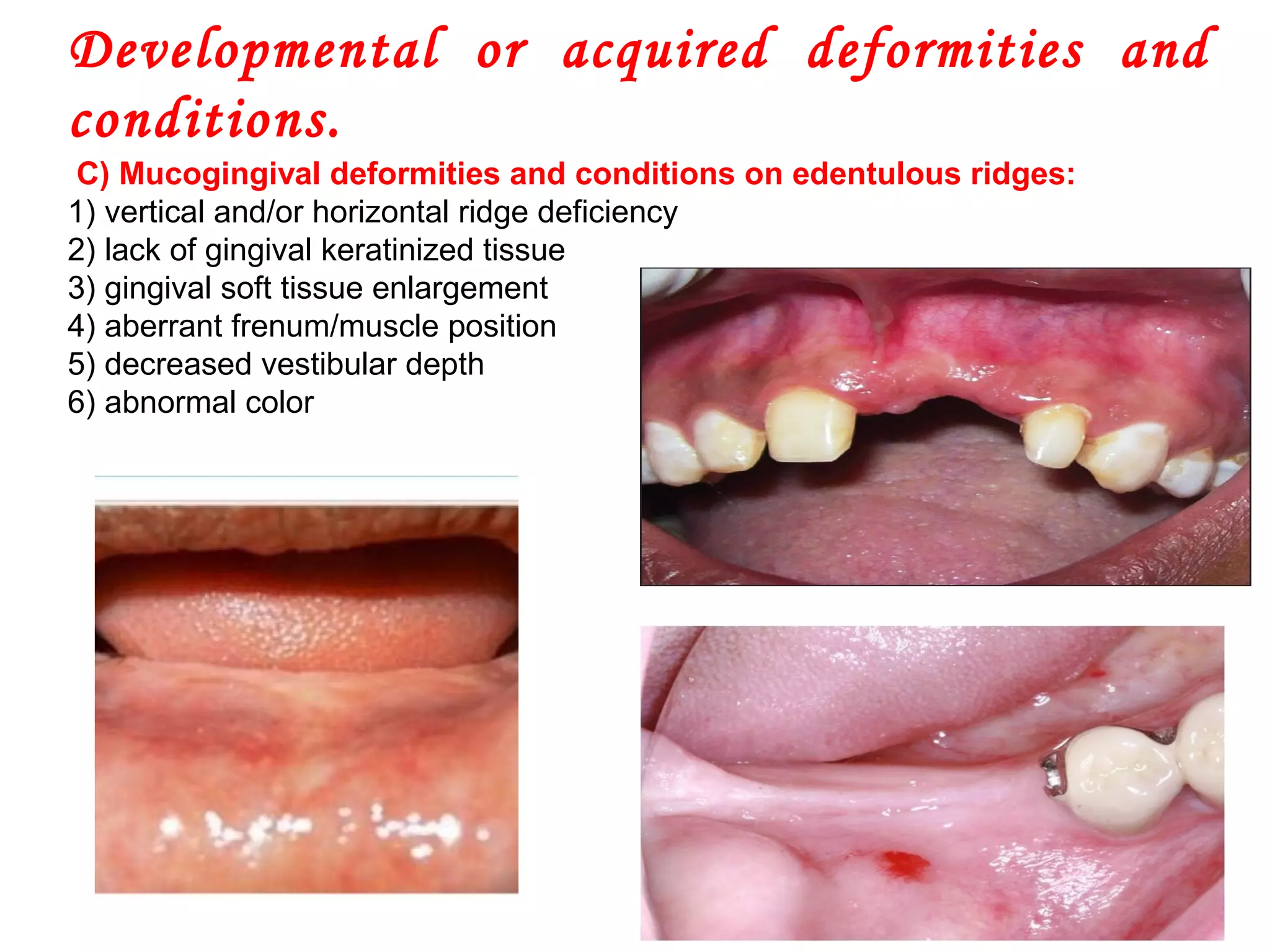 Classification of periodontal diseases | PPT