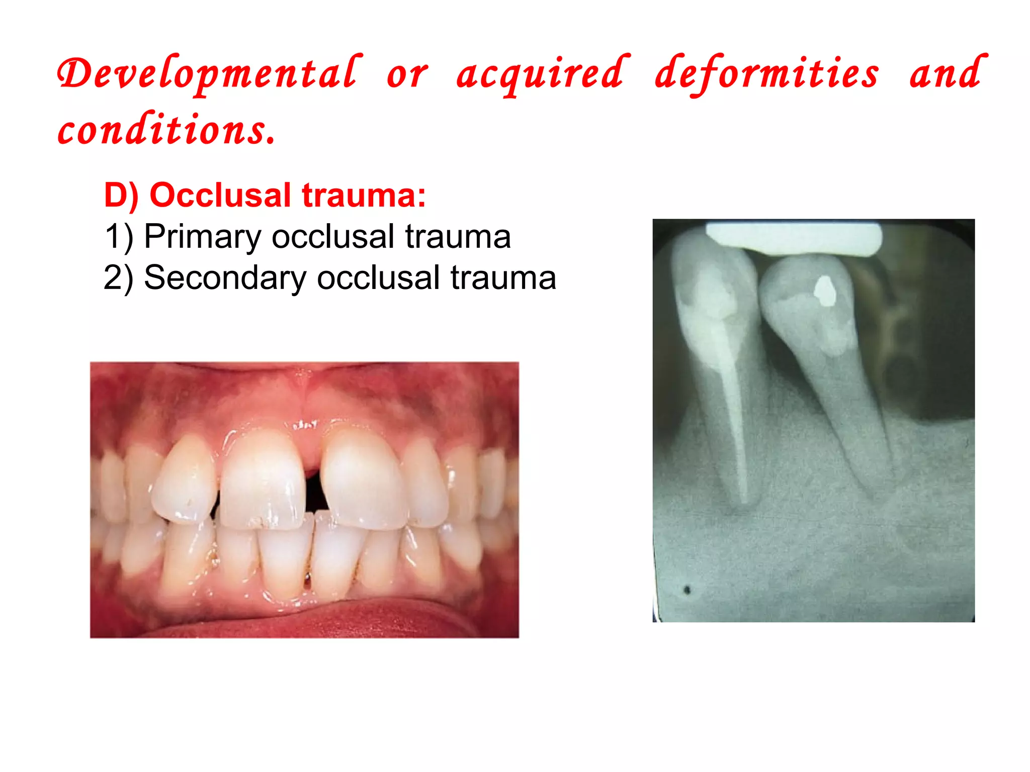 Classification of periodontal diseases | PPT
