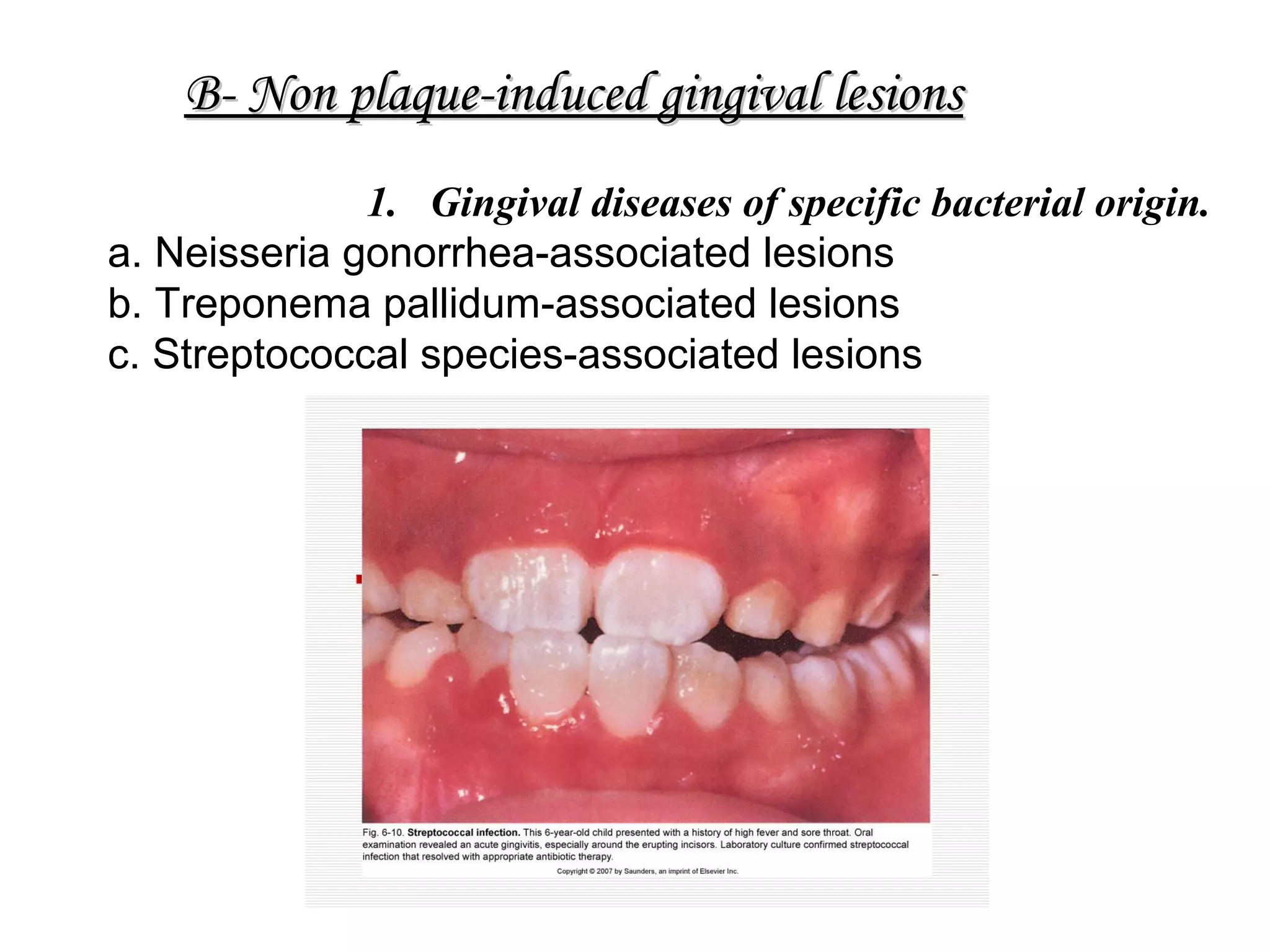 Classification of periodontal diseases | PPT