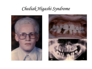 Classification of periodontal diseases | PPT