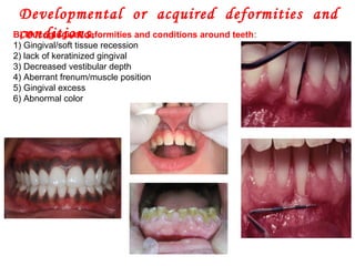 Classification of periodontal diseases | PPT