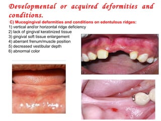 Classification of periodontal diseases | PPT