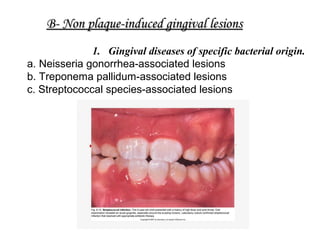 Classification of periodontal diseases | PPT