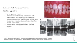 Classification of Periodontal Diseases.pptx