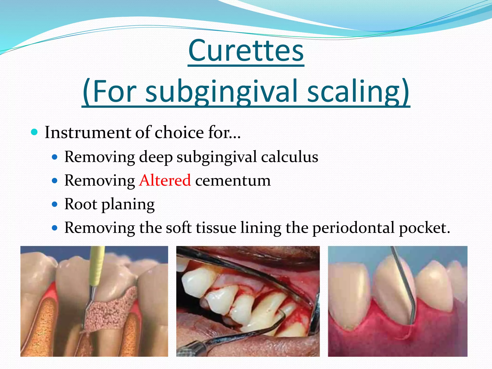 Classification of periodontal instruments | PPTX