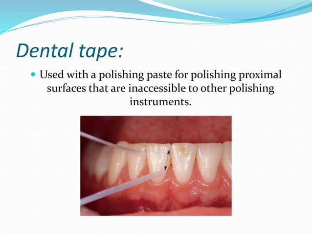 Classification of periodontal instruments | PPTX