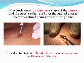 Classification of periodontal instruments | PPTX
