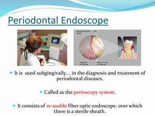 Classification of periodontal instruments | PPTX