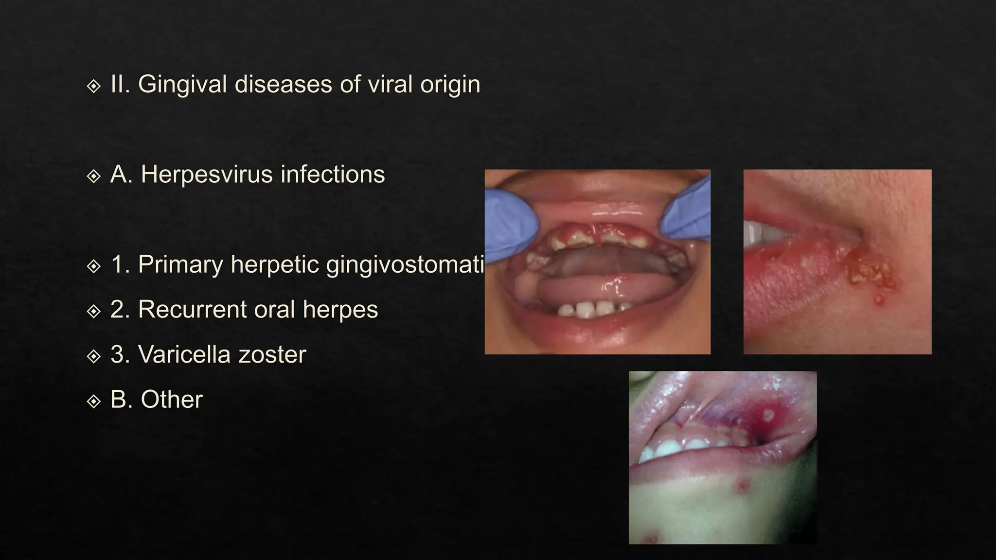 Classification of periodontitis | PPT