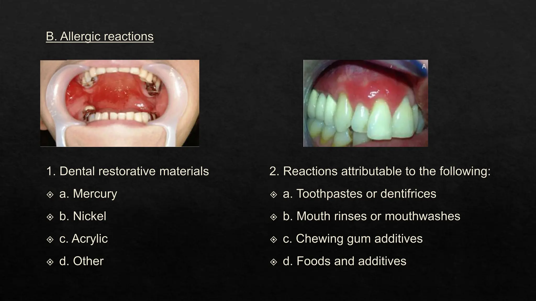 Classification of periodontitis | PPT