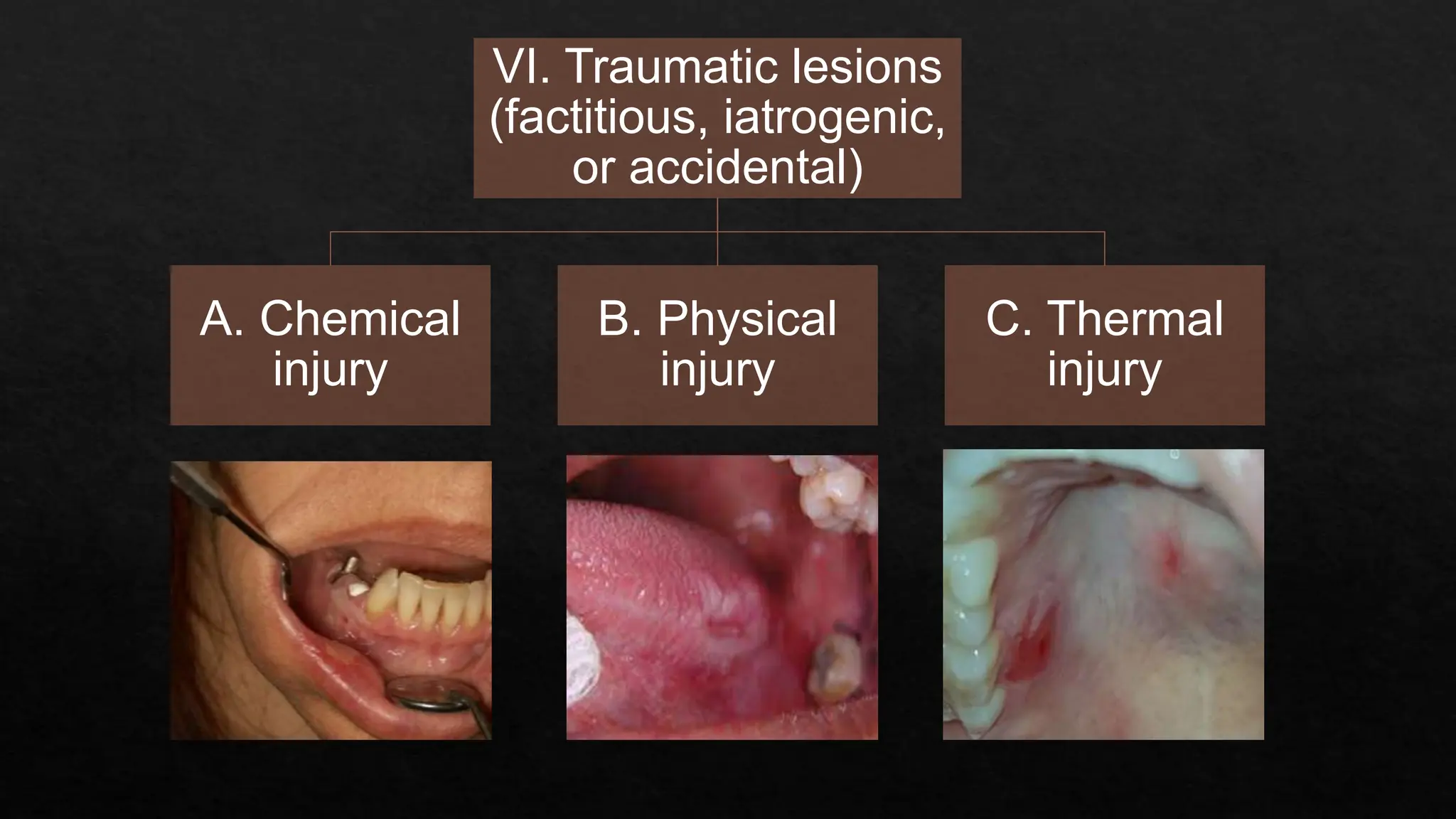 Classification of periodontitis | PPT