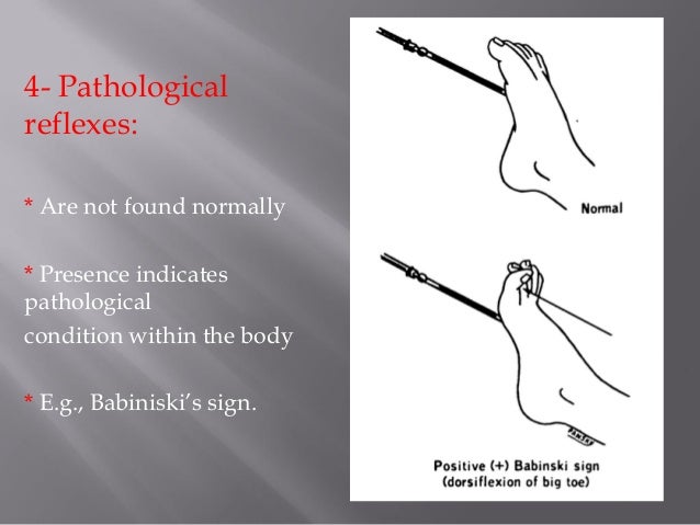 Classification of reflexes