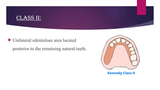 CLASSIFICATION OF REMOVABLE PARTIAL DENTURE.pptx