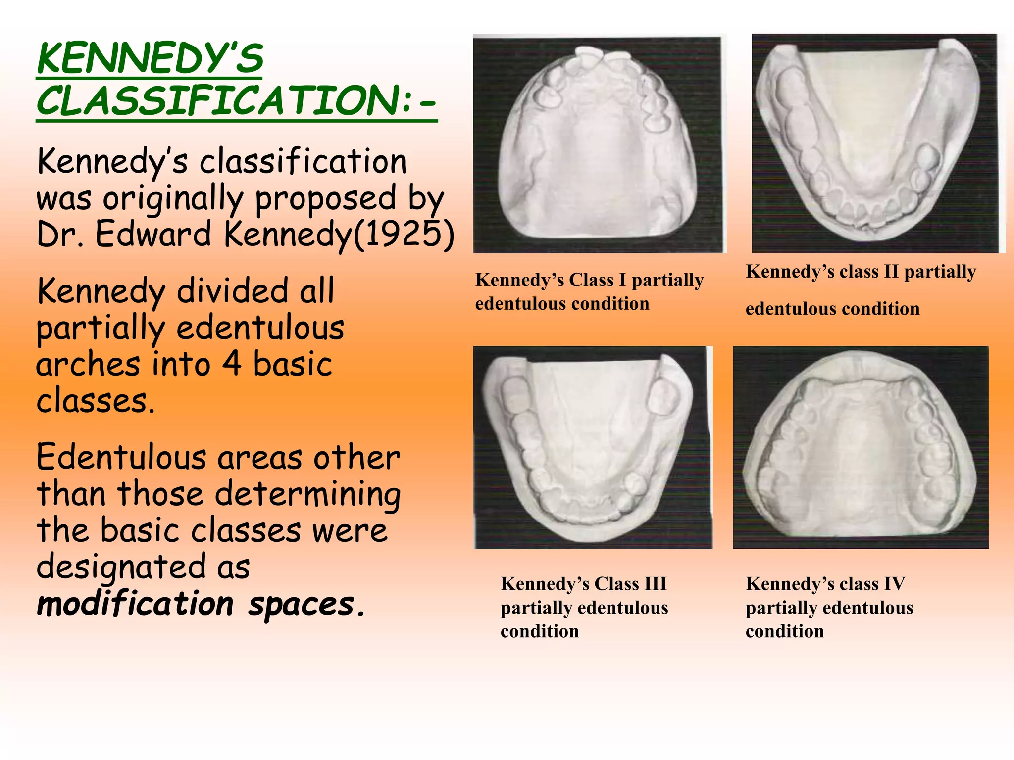 CLASSIFICATION OF RPD.ppt