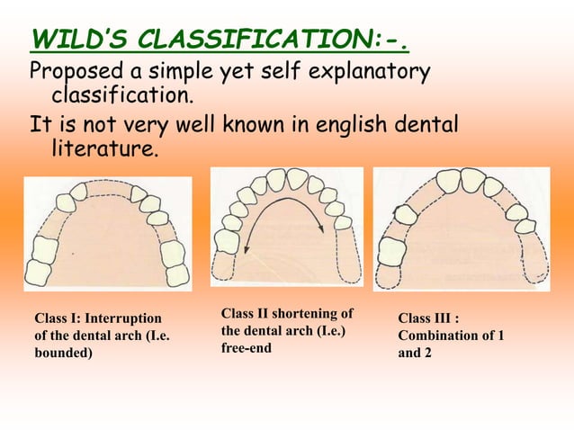CLASSIFICATION OF RPD.ppt | Dental Health | Diseases and Conditions