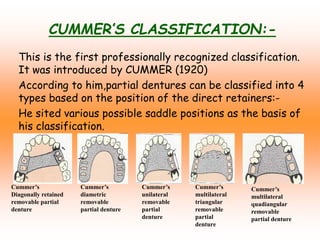 CLASSIFICATION OF RPD.ppt