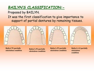 CLASSIFICATION OF RPD.ppt