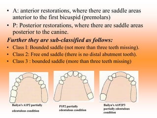 CLASSIFICATION OF RPD.ppt