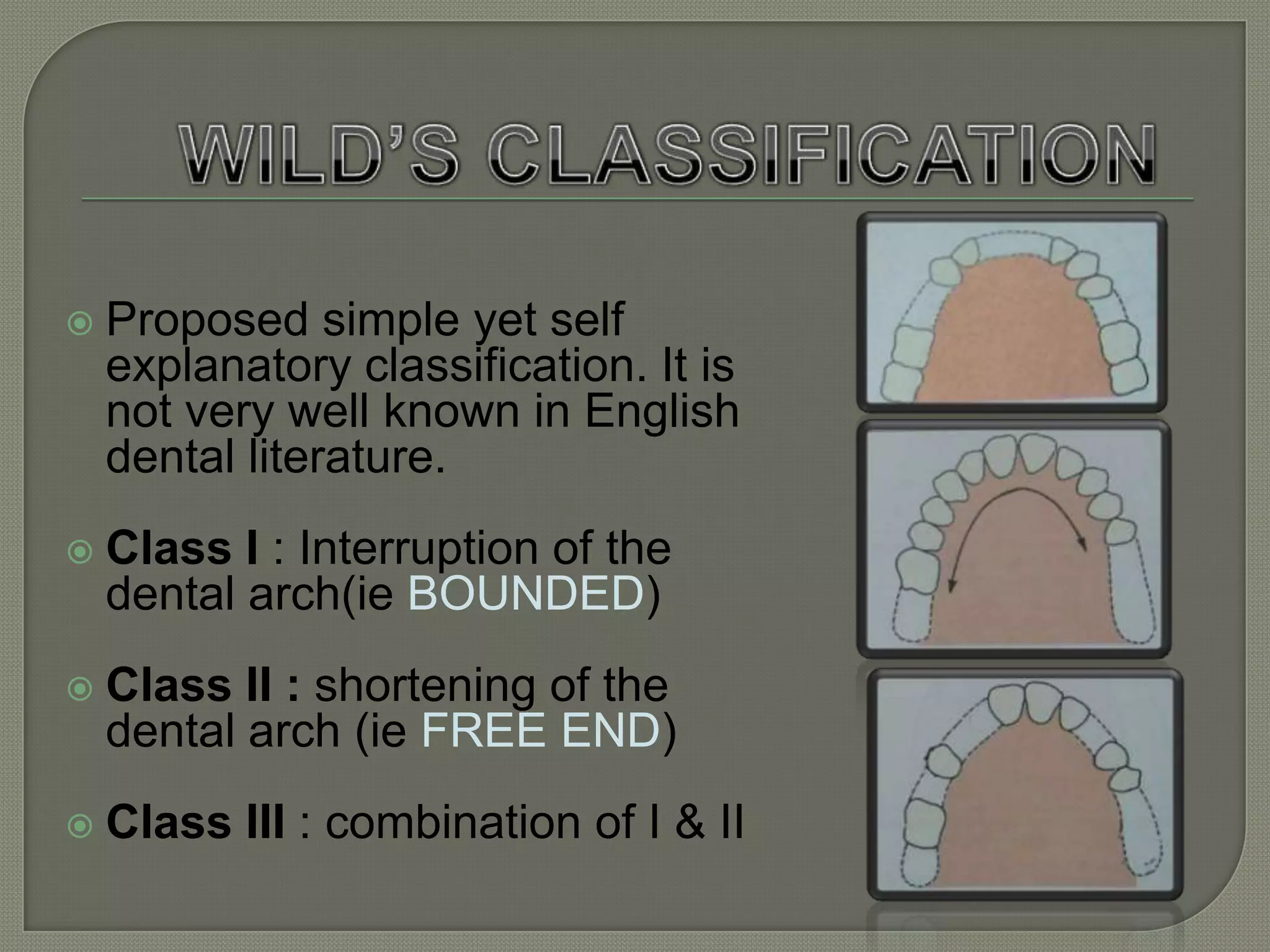 Classification of rpd | PPTX