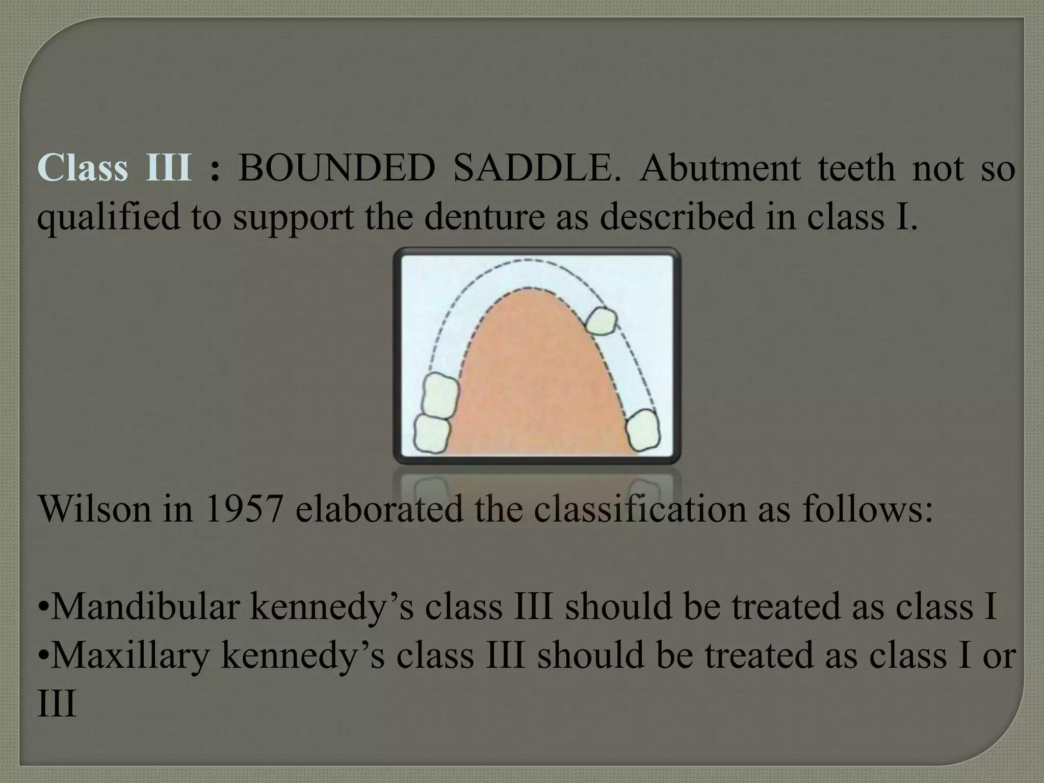 Classification of rpd | PPTX