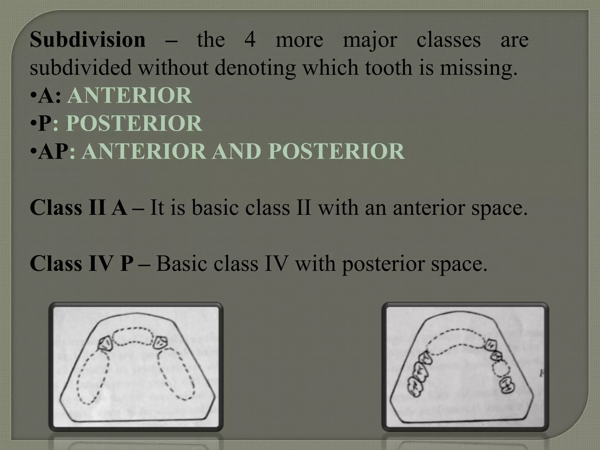 Classification of rpd | PPTX