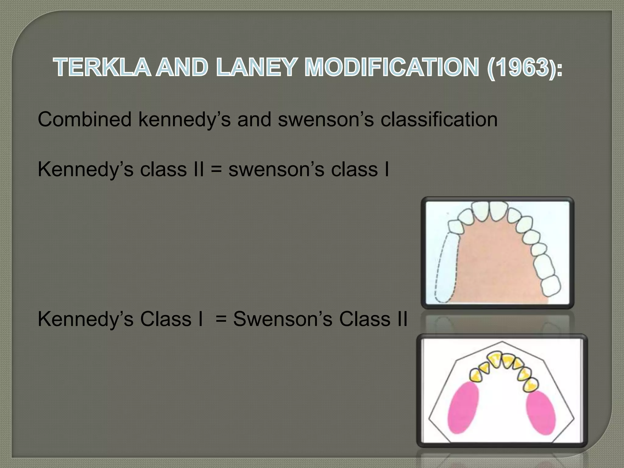 Classification of rpd | PPTX