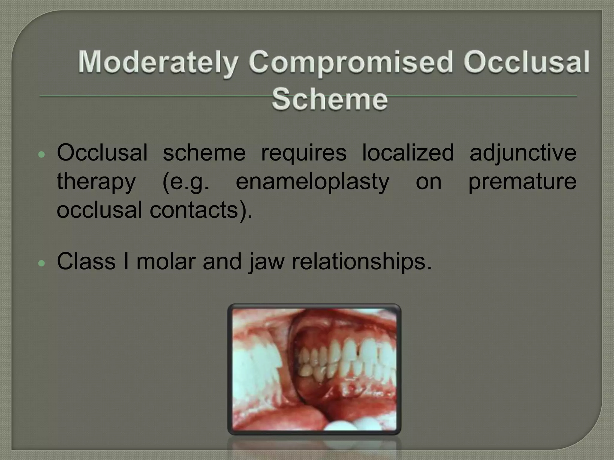 Classification of rpd | PPTX