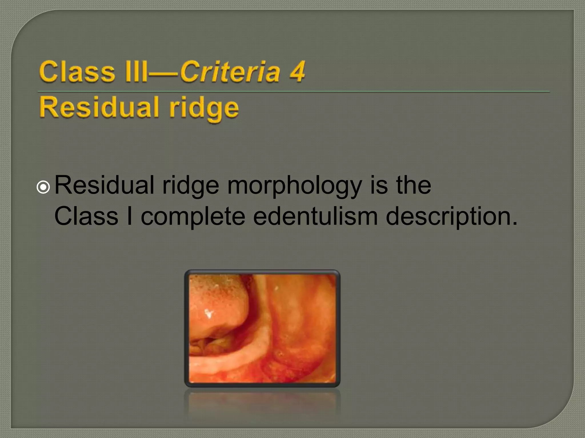 Classification of rpd | PPTX