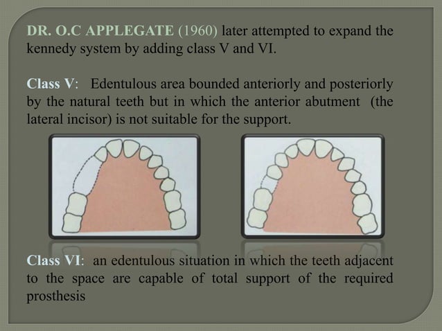 Classification of rpd | PPTX | Dental Health | Diseases and Conditions