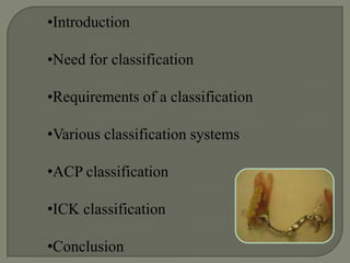 Classification of rpd | PPTX