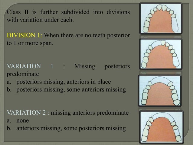 Classification of rpd | PPTX | Dental Health | Diseases and Conditions