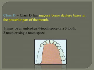 Classification of rpd | PPTX