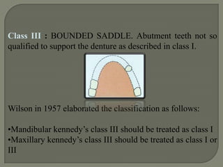 Classification of rpd | PPTX