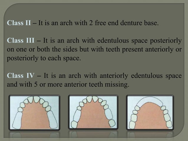 Classification of rpd | PPTX | Dental Health | Diseases and Conditions