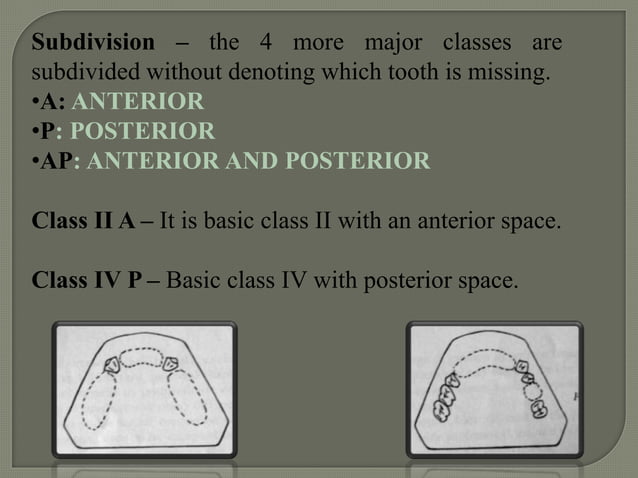 Classification of rpd | PPTX | Dental Health | Diseases and Conditions