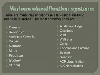 Classification of rpd | PPTX
