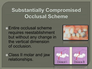 Classification of rpd | PPTX