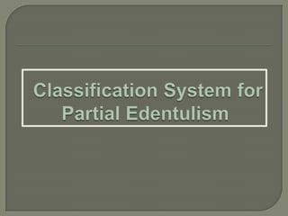 Classification of rpd | PPTX