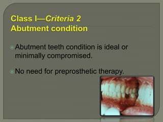 Classification of rpd | PPTX