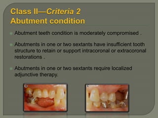 Classification of rpd | PPTX