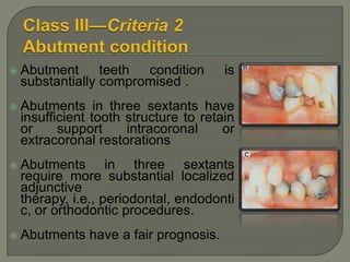 Classification of rpd | PPTX