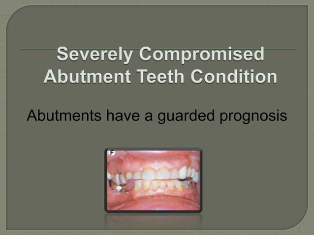 Classification of rpd