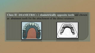 Classification of rpd (lecture) | PPSX