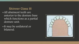 Classification of rpd (lecture) | PPSX