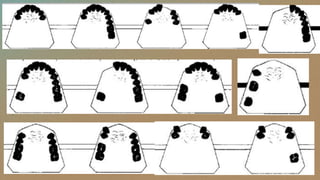 Classification of rpd (lecture) | PPSX