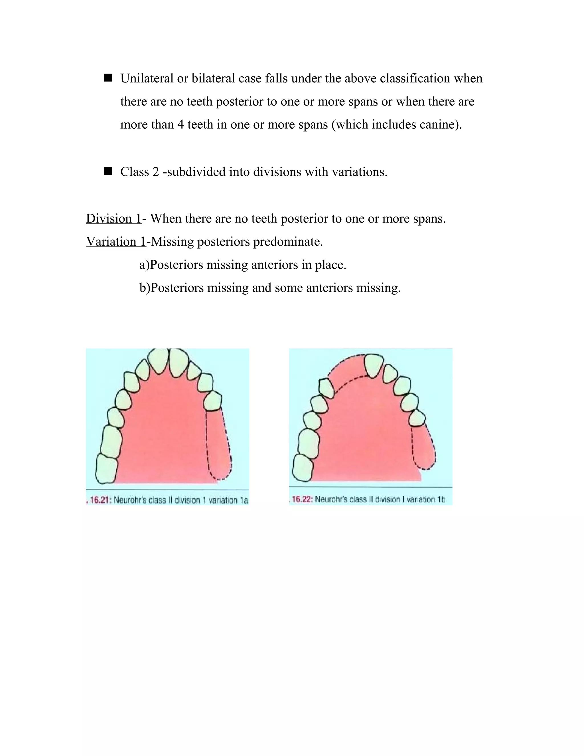 Classification of RPD/cosmetic dentistry course by Indian dental ...