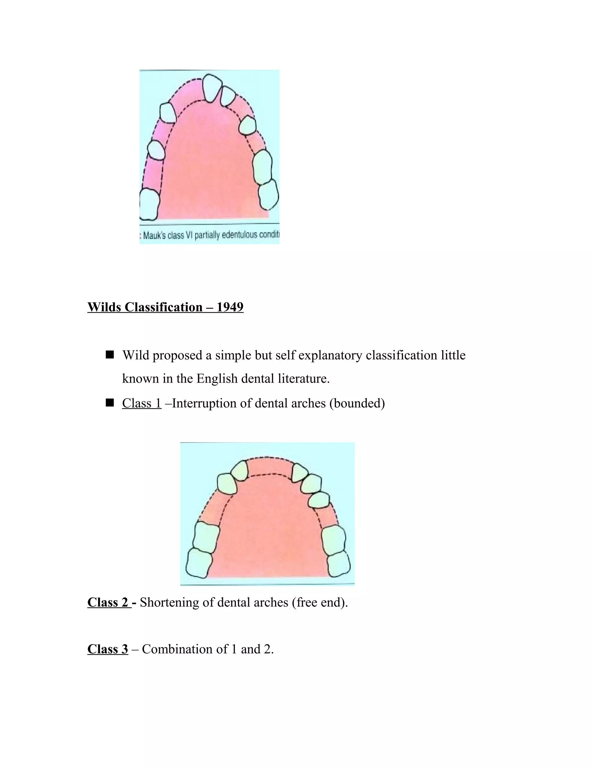 Classification of RPD/cosmetic dentistry course by Indian dental ...
