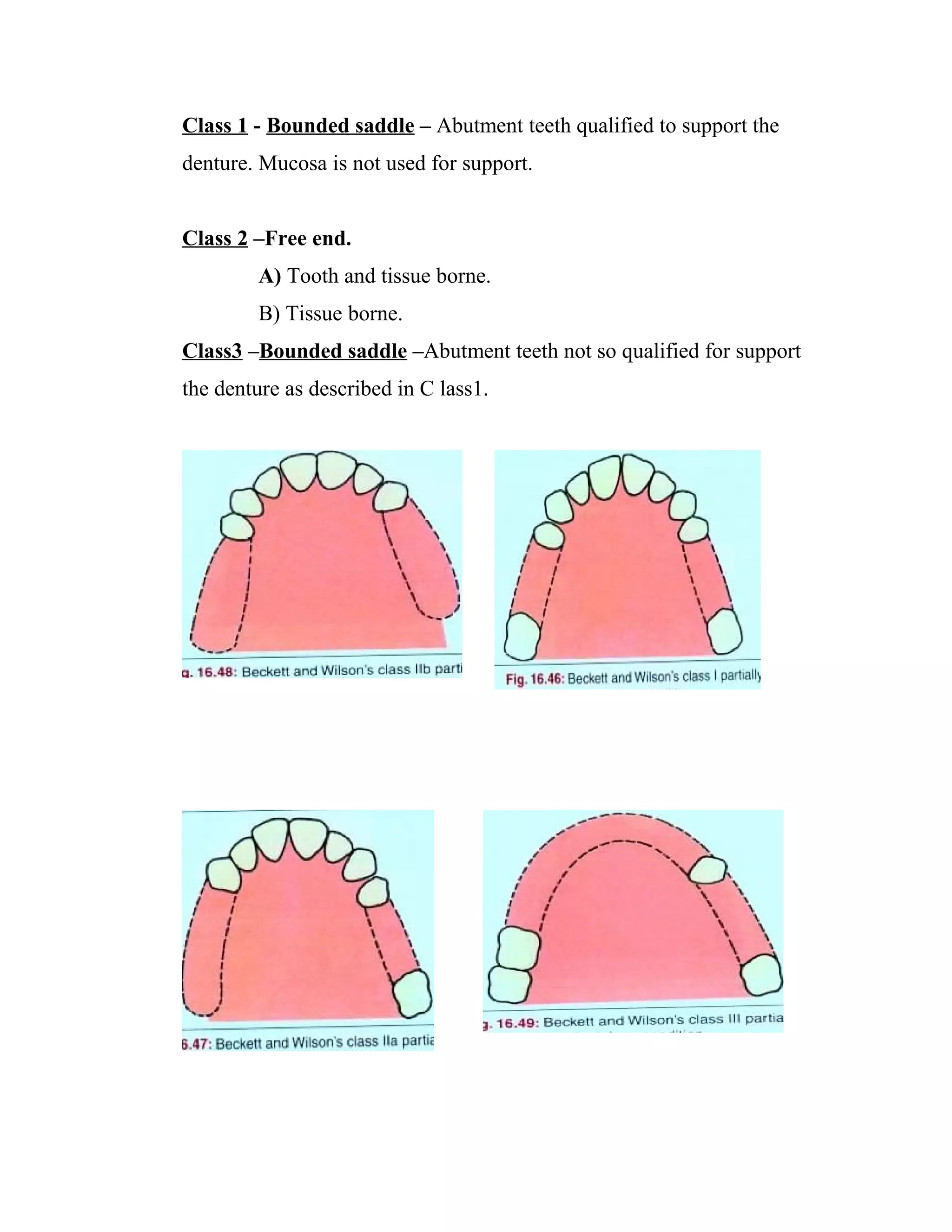 Classification of RPD/cosmetic dentistry course by Indian dental ...