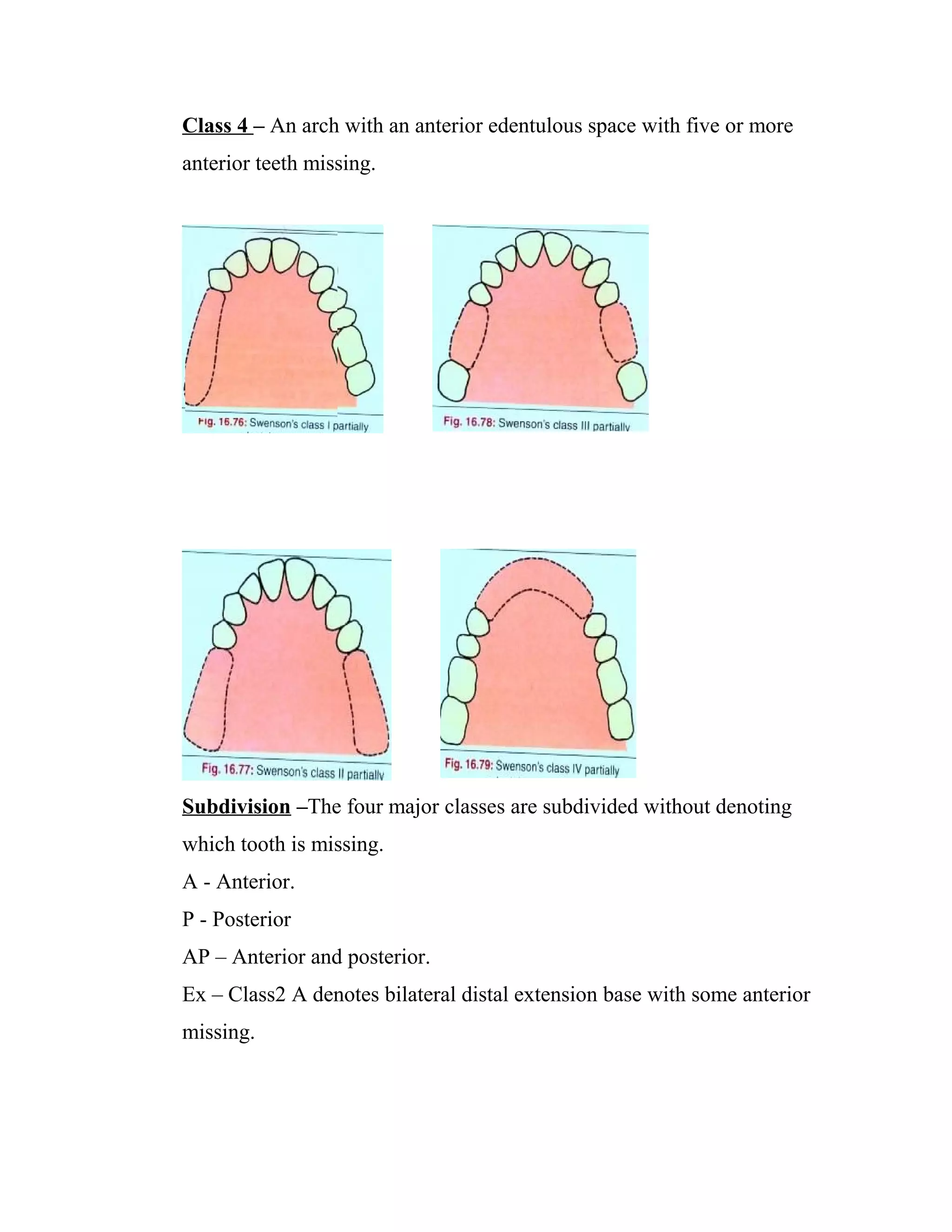 Classification of RPD/cosmetic dentistry course by Indian dental ...