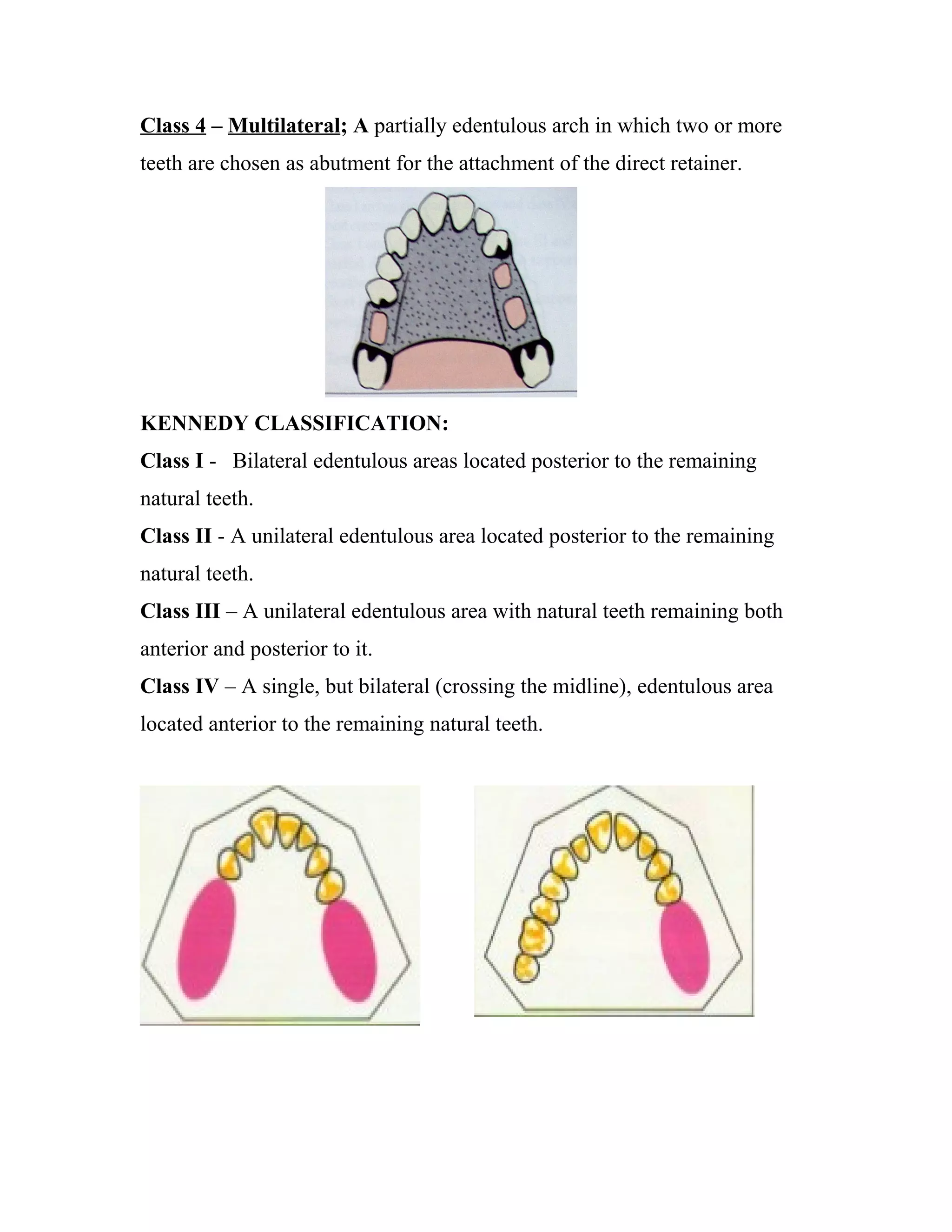 Classification of RPD/cosmetic dentistry course by Indian dental ...